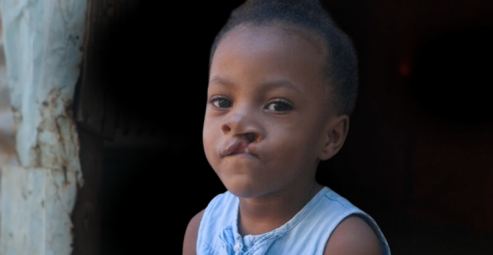 Make A Gift | Operation Smile Canada - Operation Smile Canada - Give a Child a SMILE